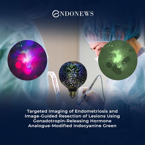 A Unique Approach For Visualising Endometriosis During Surgery Endonews