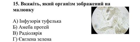 Вкажіть який організм зображений на малюнку А Інфузорія туфелька Б Амеба протей В Радіолярія