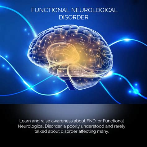 Functional Neurological Disorder Day Fnd Template Postermywall