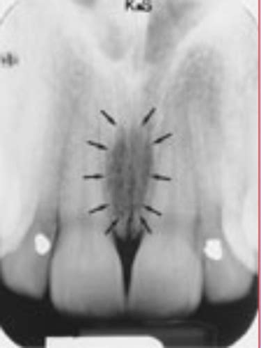 Radiology Slide Exam Flashcards Quizlet