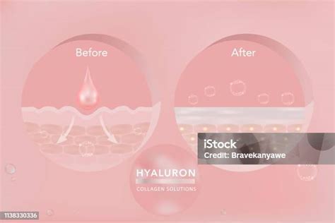 ヒアルロン酸の皮の解決の広告利用できる化粧品の広告の背景とのピンクのコラーゲンの血清の低下図ベクトル 水平アングルのベクターアート素材や