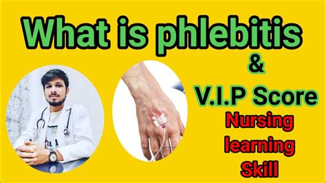 Visual Infusion Phlebitisvipscore In Hindi Peripheral Ivcannula