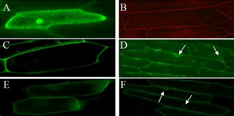 Subcellular Localization Of Ma1 Green Fluorescent Protein Gfp By
