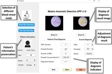 The Malaria Parasite Detection Platforms Gui Download Scientific Diagram