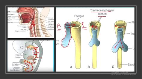 Esophagus Gi Embryology 21 Youtube