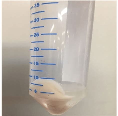 A Picture Of A Biopolymer Containing Falcon Before Cell Mass Separation