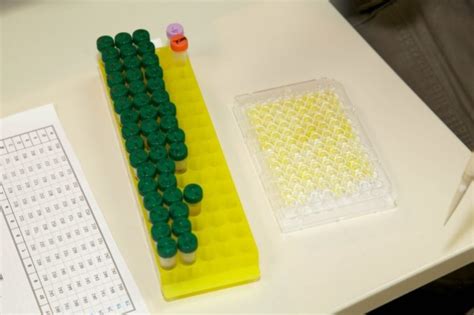 Si Sottopone Per Gioco Al Test Del Dna E Scopre Di Avere Una