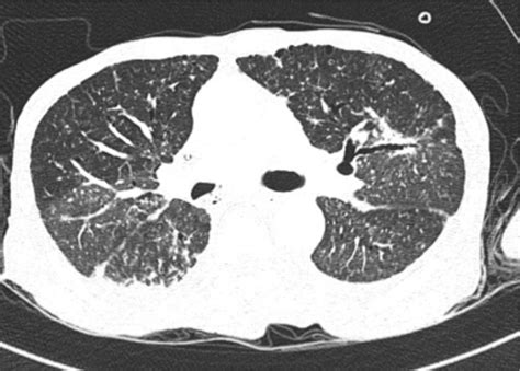 대한심장호흡재활의학회지 Annals Of Cardiopulmonary Rehabilitation