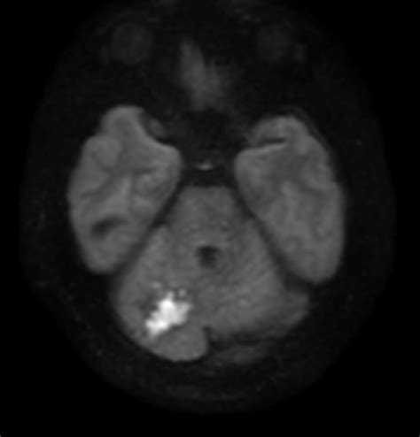 Mri Simulation With Dwi Tse And Flair Philips Mr Body Map