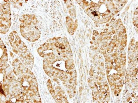 Bbs10 Polyclonal Antibody Invitrogen™ 100 μl Unconjugated Fisher