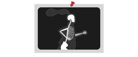 Musculoskeletal System 2 The Mcat Webinar