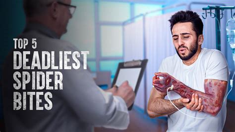 Survive The 5 Deadliest Spider Bites Safely Ww3 Survival