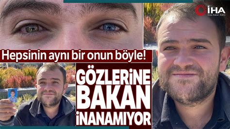 Bir Gözü Mavi Bir Gözü Yeşil Olan Adamı Gören Şaşırıyor YouTube