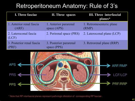 Ppt Overview Of Retroperitoneal Anatomy Masses And Disease Spread Imaging Powerpoint