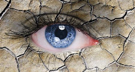 Sjögrens Syndrome The Need To Bridge Patient Symptoms And Objective