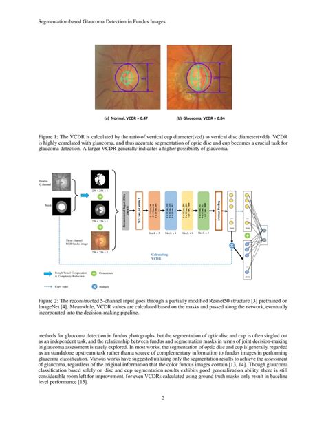 Segmentation Based Information Extraction And Amalgamation In Fundus
