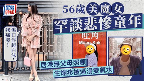 56歲凍齡美魔女自爆有悲慘童年！居港無父母照顧 全身生爛疹被逼浸雙氧水傷口起白沫