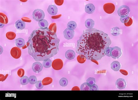 Auer Rods Or Auer Bodies In Acute Hypergranular Promyelocytic