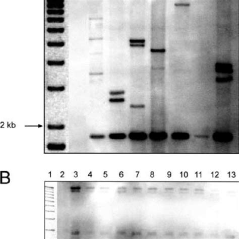 A B Southern Analysis Of Transgenic Rice Plants Ten Micrograms Of