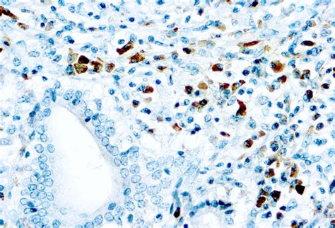 Mouse Anti Human Kappa Light Chain Antibody Kp53 Ready To Use