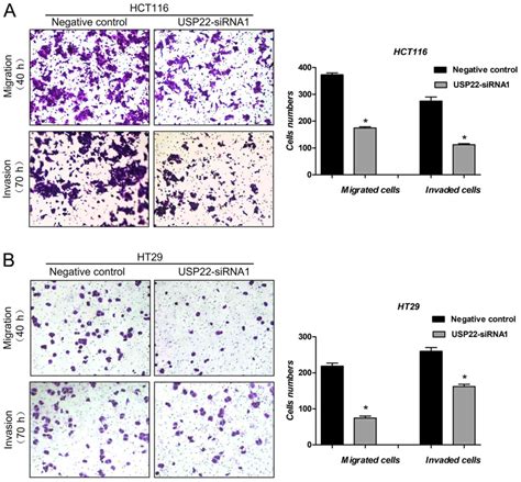 Ubiquitin‑specific Peptidase 22 Promotes Proliferation And Metastasis
