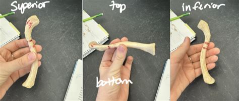 Clavicle Diagram Quizlet