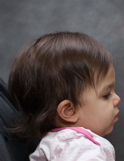 Photo Gallery Nj Craniofacial Centers