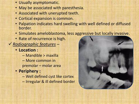 Mixed Radiopaque And Radiolucent Lesions Of Jaw Pptx