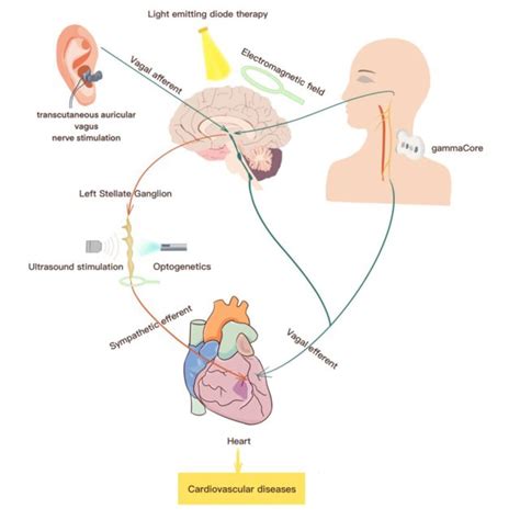 Summary Of Potential Non Invasive Neuromodulations For The Treatment