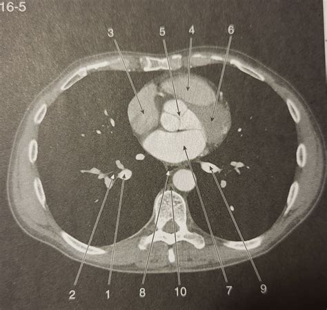 Thoracic Anatomy Diagram Quizlet