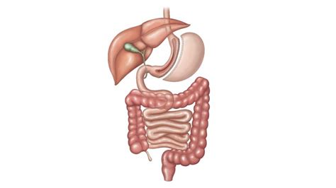 Sleeve Gástrico Ou Gastrectomia Vertical Ethicon