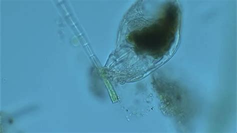Trichocerca Rotifer Youtube