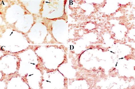 Figure 1 From TGF B 3 Null Mutation Does Not Abrogate Fetal Lung