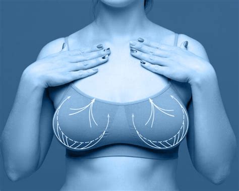 Breast Reduction Surgery Palm Beach Dermatology Group