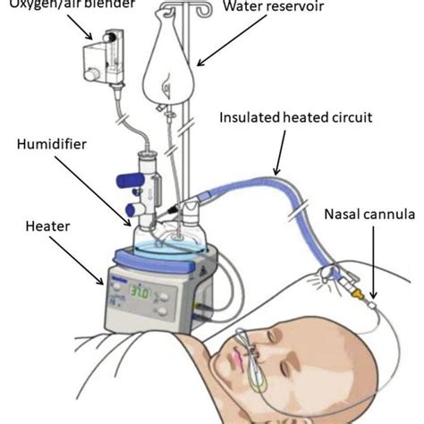 Components Of The Hfnc System A Oxygen Air Blender Water Reservoir