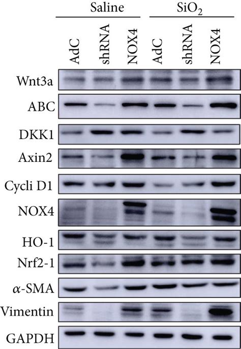Effects Of Nox4 On Wnt β Catenin Signaling And Emt Of Lung Epithelial