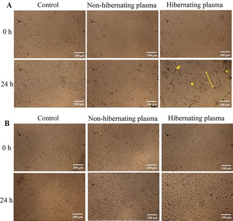 Effects Of Hibernating Plasma On The Morphology Of 4T1 Breast Cancer