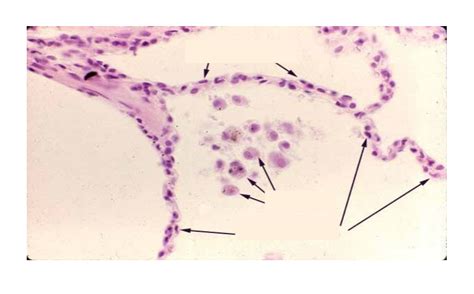 Simple Squamous Epithelium Location And Function Quizlet At Cristal Lawrence Blog