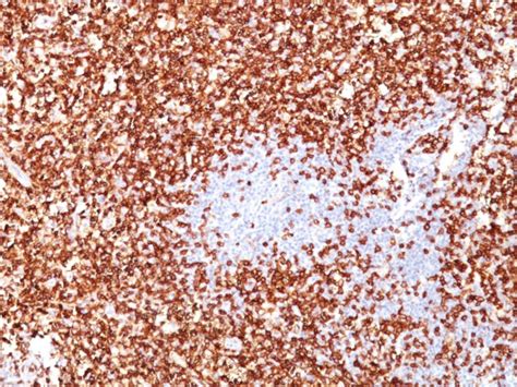 Cd45ro T Cell Marker Monoclonal Antibody Uchl 1 T200 797 5788