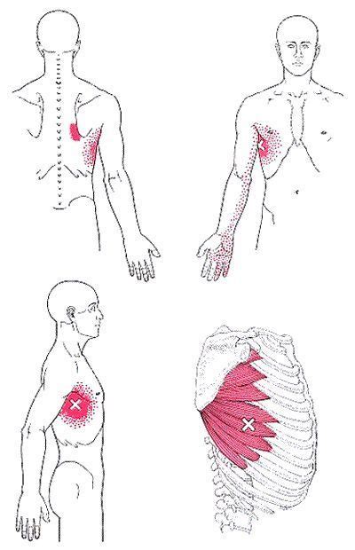 Hand Therapy Physical Therapy Medical Symptoms Shoulder Rehab