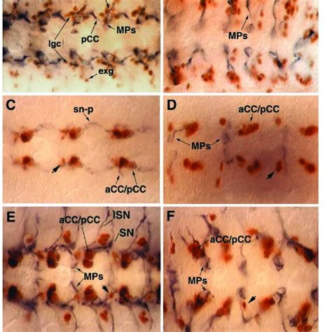 Defects In Neural Morphogenesis And Axonal Pathfinding In Fas Mutant