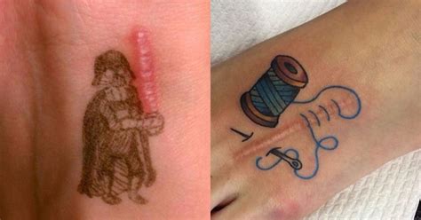 Scars Transformed Into Clever Works Of Art