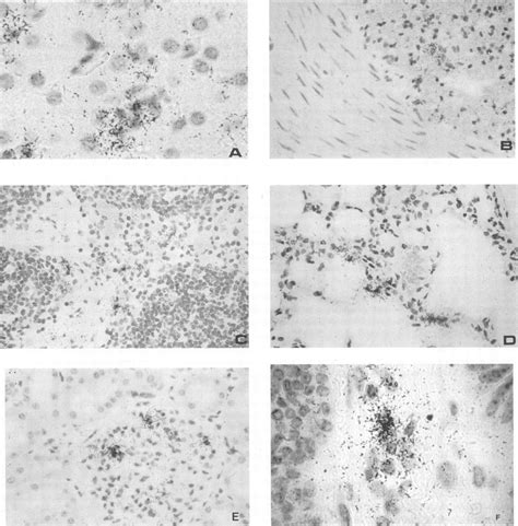In Situ Hybridization Of Paraffin Embedded Tissue Sections Collected On