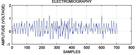 Myoelectric Signal Produced By The Little Finger Download Scientific Diagram