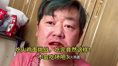 吃火鸡面挑战，吃完竟然这样！不会吃坏吧？ Youtube