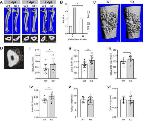 Ccl2 Ccr2 Signalling In Mesenchymal Stem Progenitor Cell Recruitment And Fracture Healing In