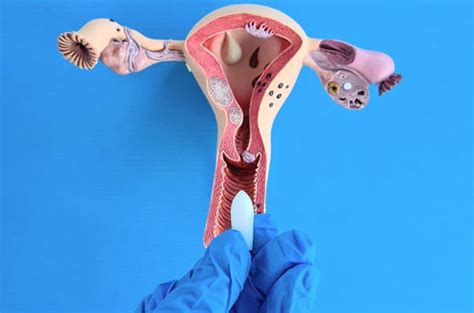 Pelvic Organ Prolapse Management Gayatri Maternity