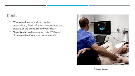 Identify The Symptoms And Clinical Manifestations Of Pericarditis Ppt