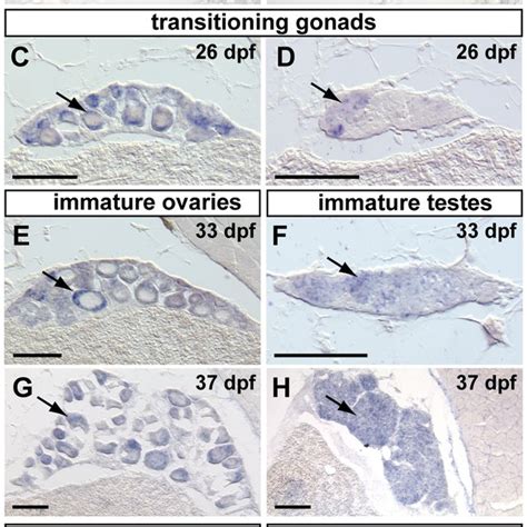 Zebrafish Germ Cells Express Fancl During Gonad Development In Situ