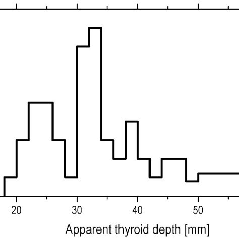 Iodine 131 I Spectrum With Marked Areas Under Main Energy Peak Of 364